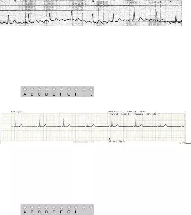 Blank Ekg Practice Form | Fill Out and Print PDFs