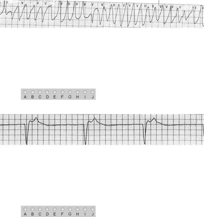 Blank Ekg Practice Form | Fill Out and Print PDFs