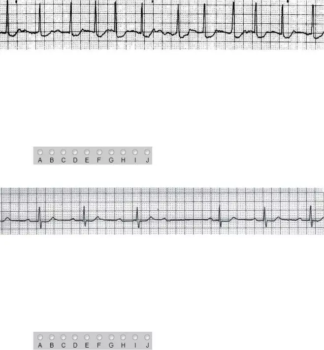 Blank Ekg Practice Form | Fill Out and Print PDFs